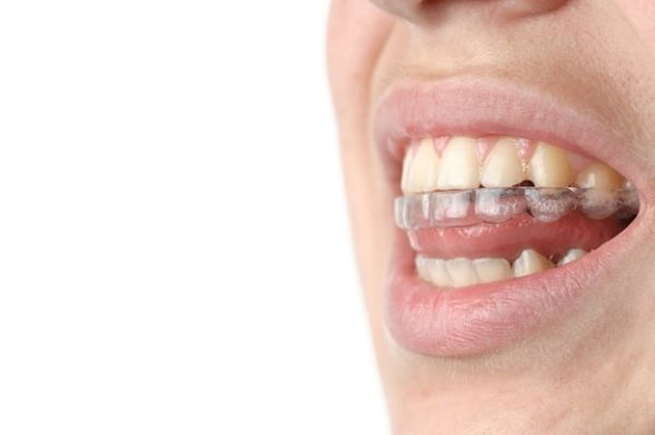 Understanding Tongue Thrust: Causes, Symptoms, and Treatment Options