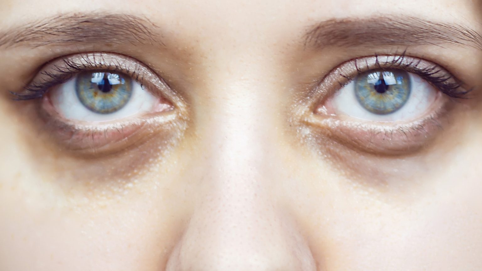 Allergy Shiners: The Orofacial Myology Connection - Center for ...